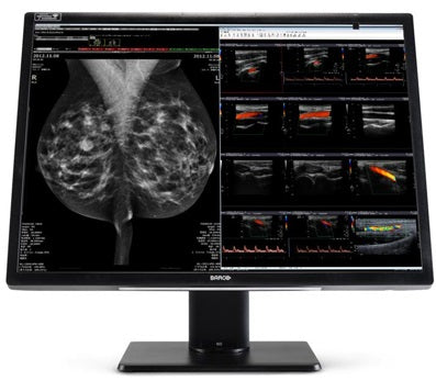 Barco Nio Fusion 12MP (MDNC-12130) – ELECOM SYSTEMS