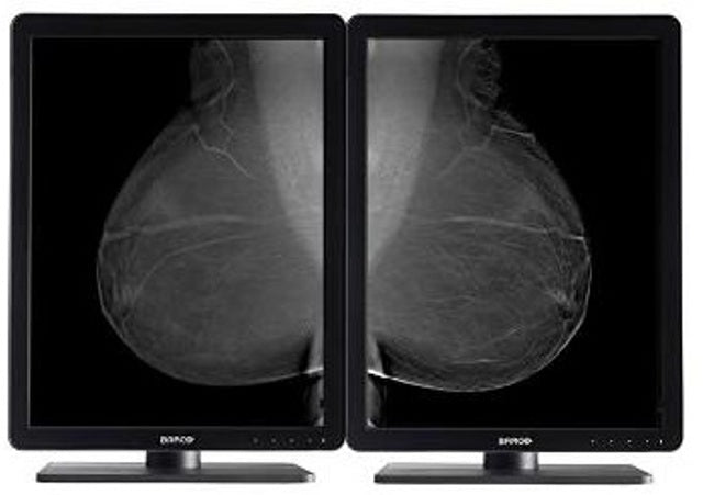 Barco Nio 5MP-2H LED Grayscale – ELECOM SYSTEMS