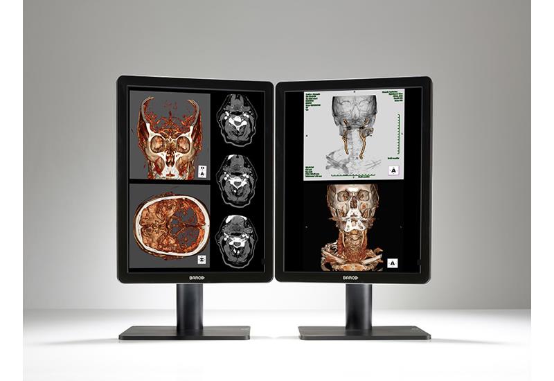 Barco Nio Color 2MP-2H (MDNC-2521) – ELECOM SYSTEMS